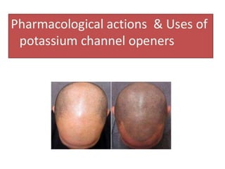 Potassium channel modulators | PPTX