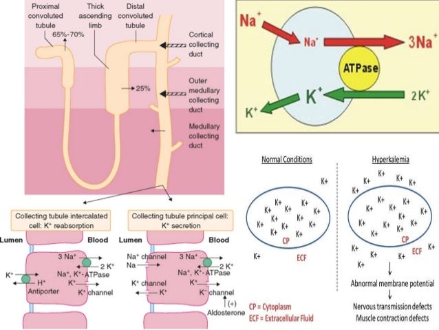 Potassium disorders , comprehensive & practical approach
