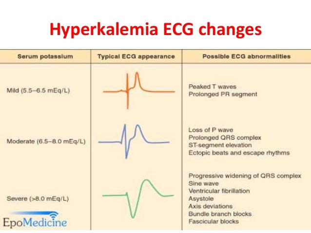 Potassium disorders , comprehensive & practical approach
