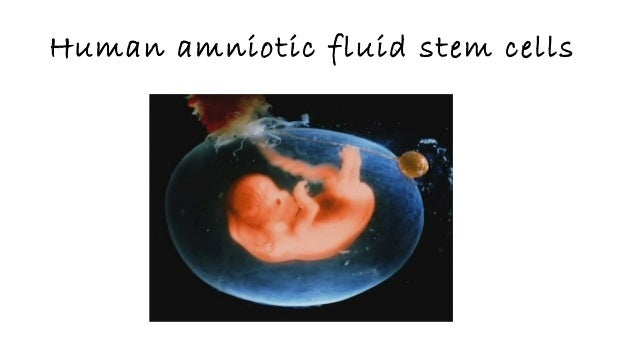 Potentals of human amniotic fluid stem cells
