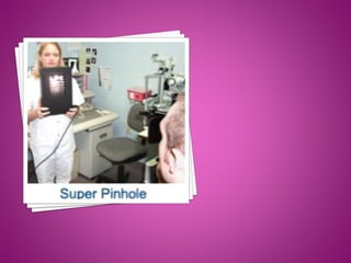 Potential acuity meter | PPTX