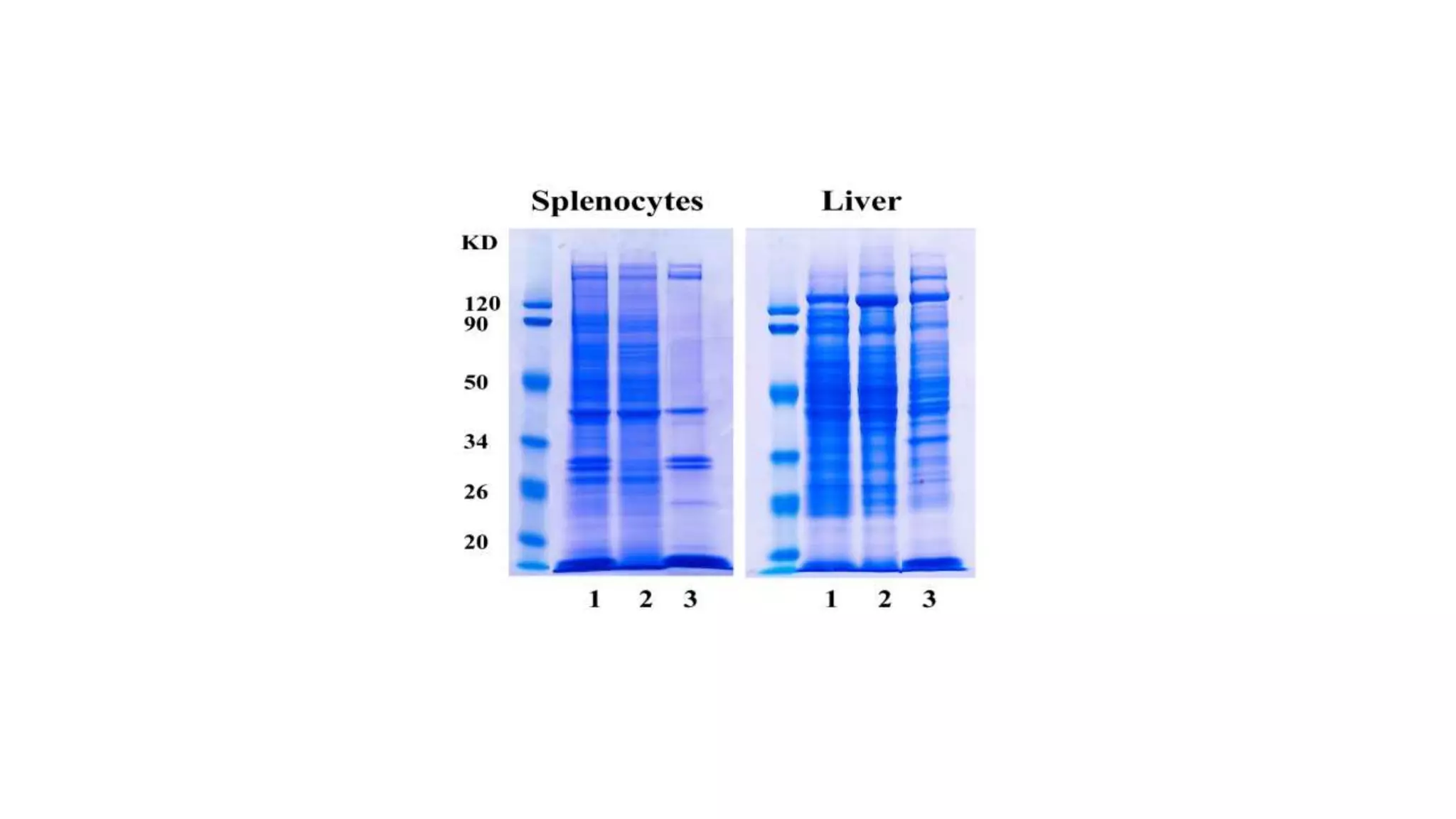 Potential problems of protein extraction using ripa buffer - Invent ...