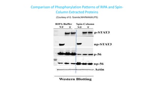 Potential problems of protein extraction using ripa buffer - Invent ...