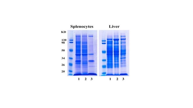 Potential problems of protein extraction using ripa buffer - Invent ...