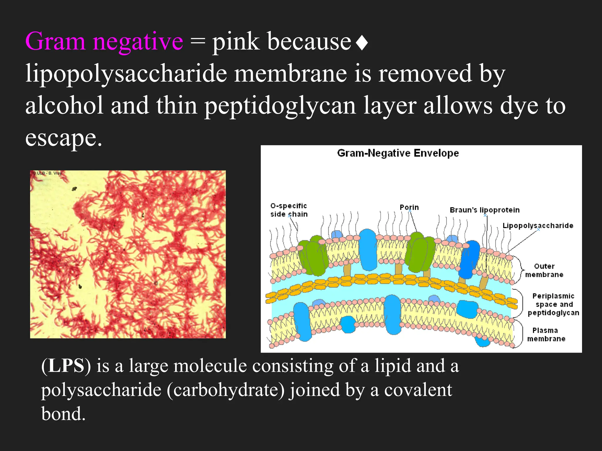 Oral Manifestation of Bacterial Manifestation- TUBERCULOSIS SYPHILIS ...