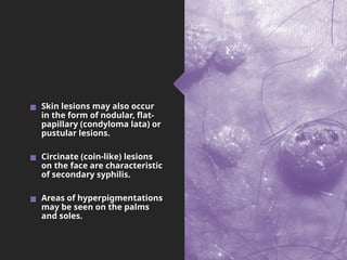 Oral Manifestation of Bacterial Manifestation- TUBERCULOSIS SYPHILIS ...