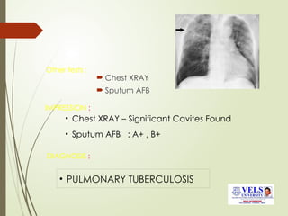 Tuberculosis case presentation for pharm.d | PPTX