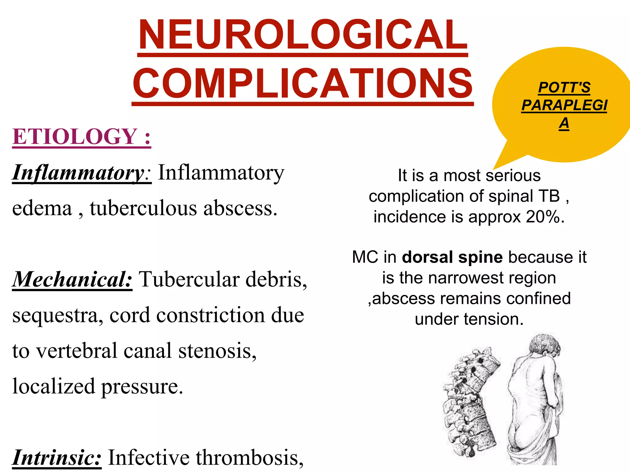 Pott's disease ppt | PPTX