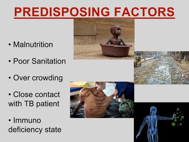 Pott's disease ppt | PPTX | Physical Therapy | Wellness