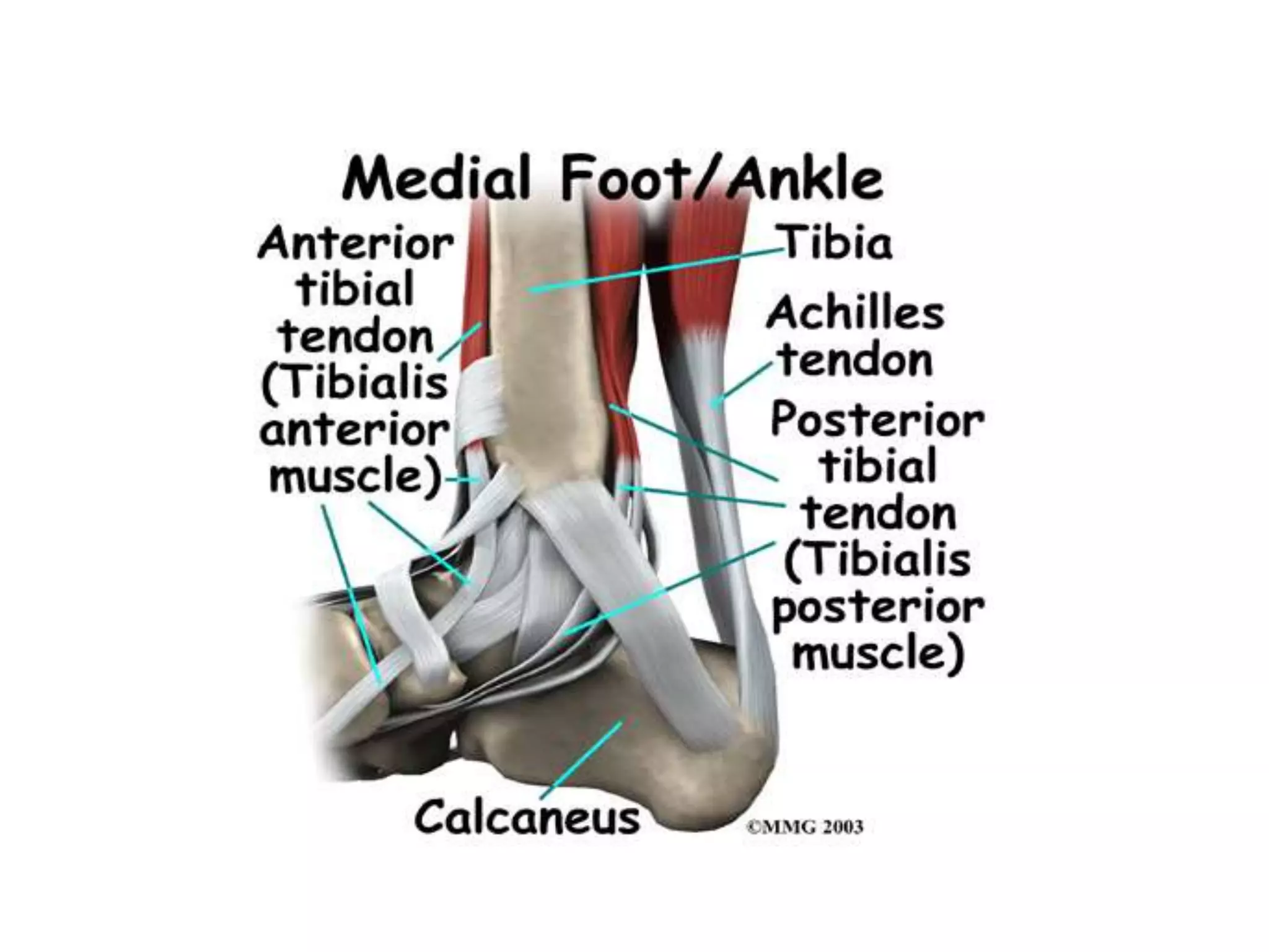 Pott’s fracture | PPTX