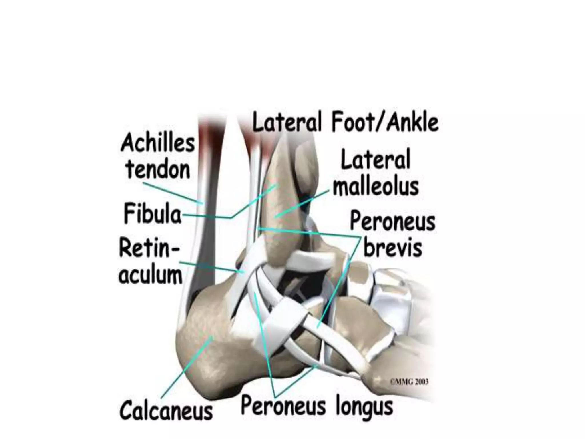 Pott’s fracture | PPTX