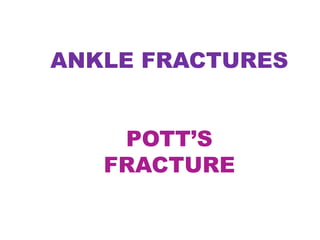 Pott’s fracture | PPTX