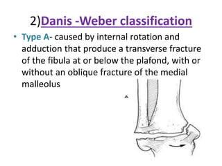 Pott’s fracture | PPTX