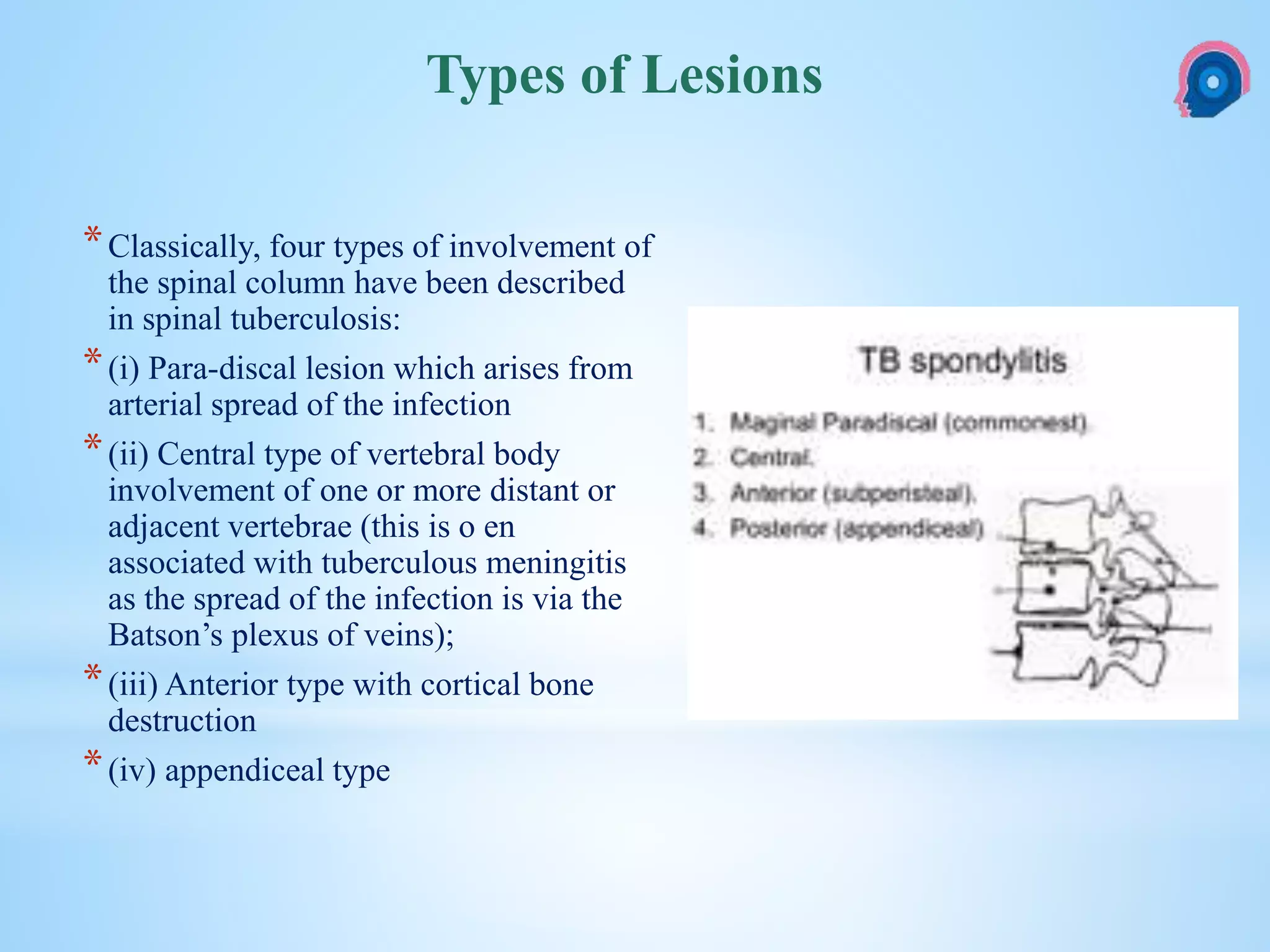 Potts Spine Tb Spine Ppt