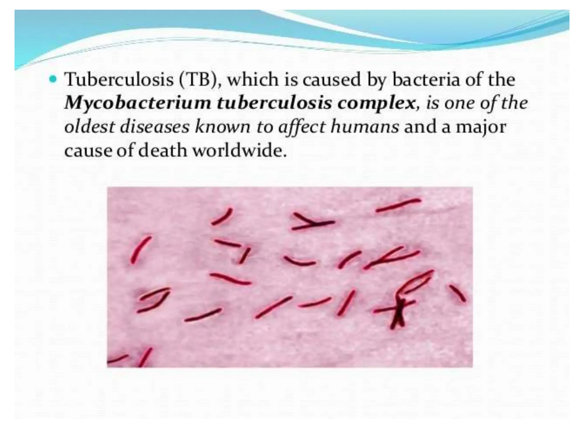 Pott's Spine. (Tuberculosis Spine) pptx | PPTX