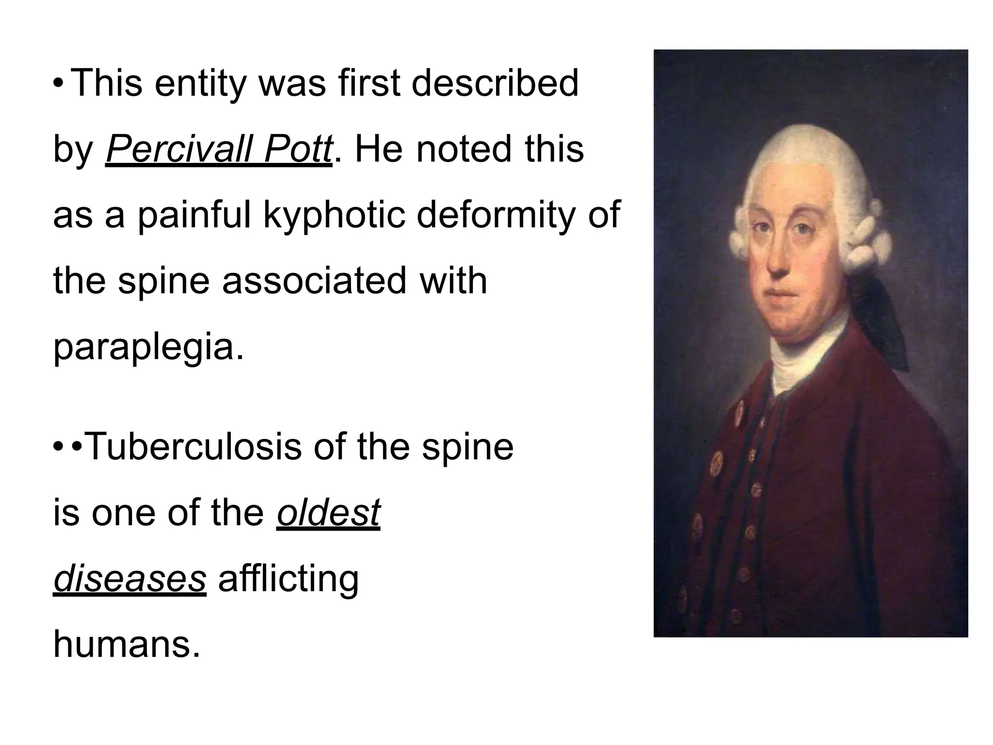 Pott's Spine. (Tuberculosis Spine) pptx | PPTX