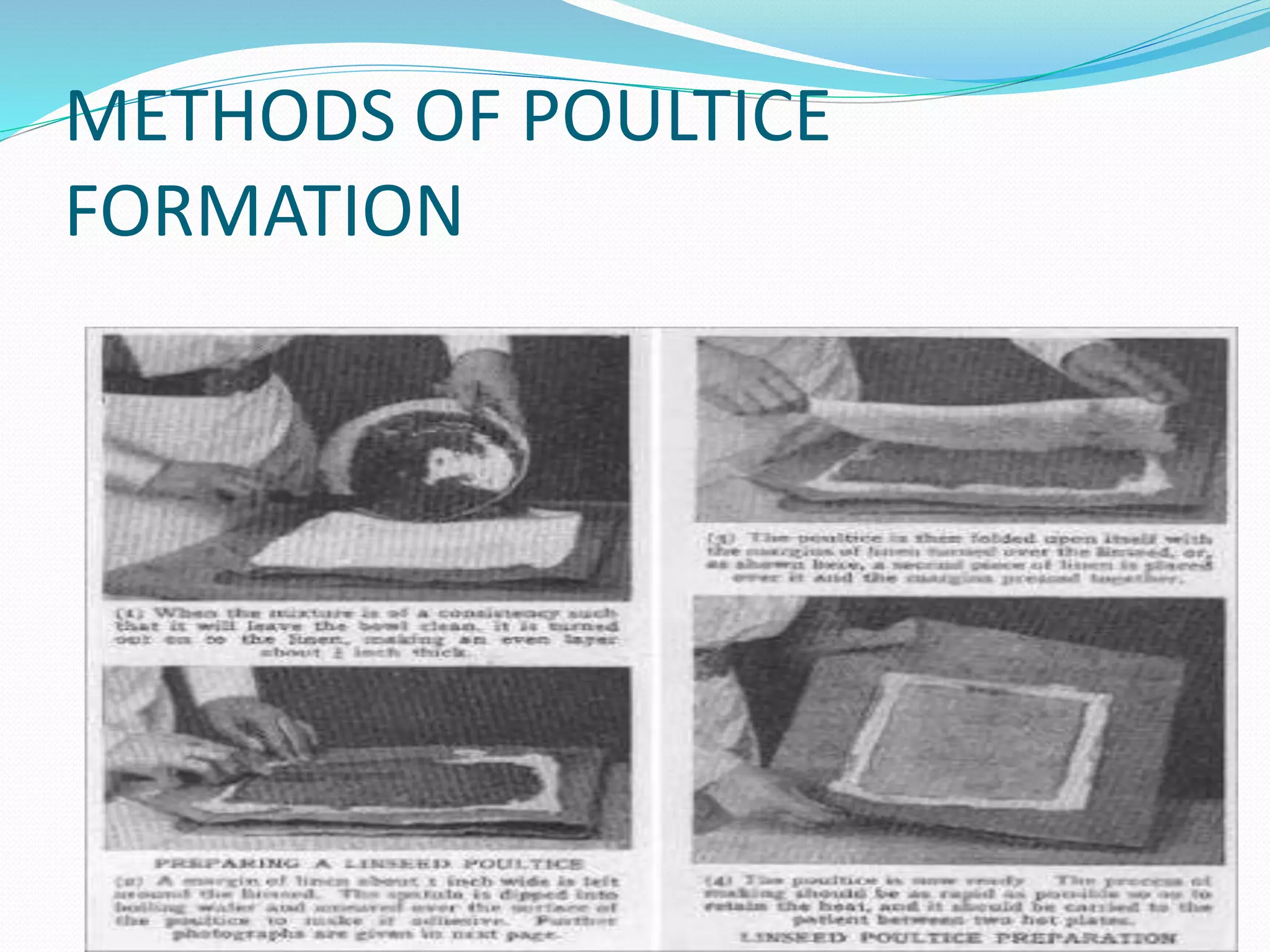 Poultices | PPTX