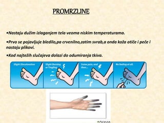 Povrede kože i prva pomoć | PPTX