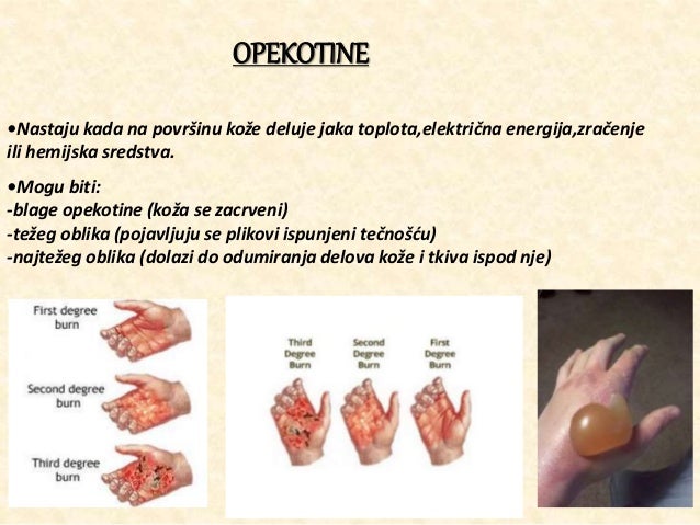 Povrede kože i prva pomoć