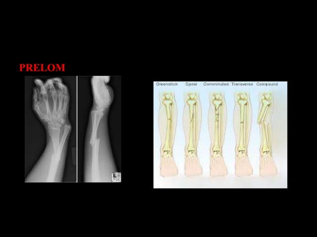 Povrede, mehanicke povrede | PPT