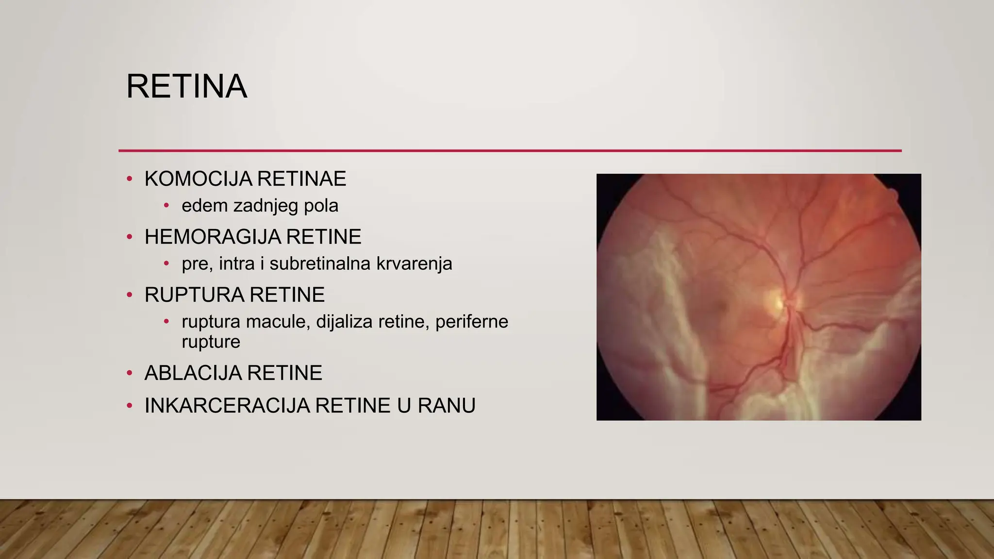 mehanicke Povrede oka i pomoc u lecenju | PPT