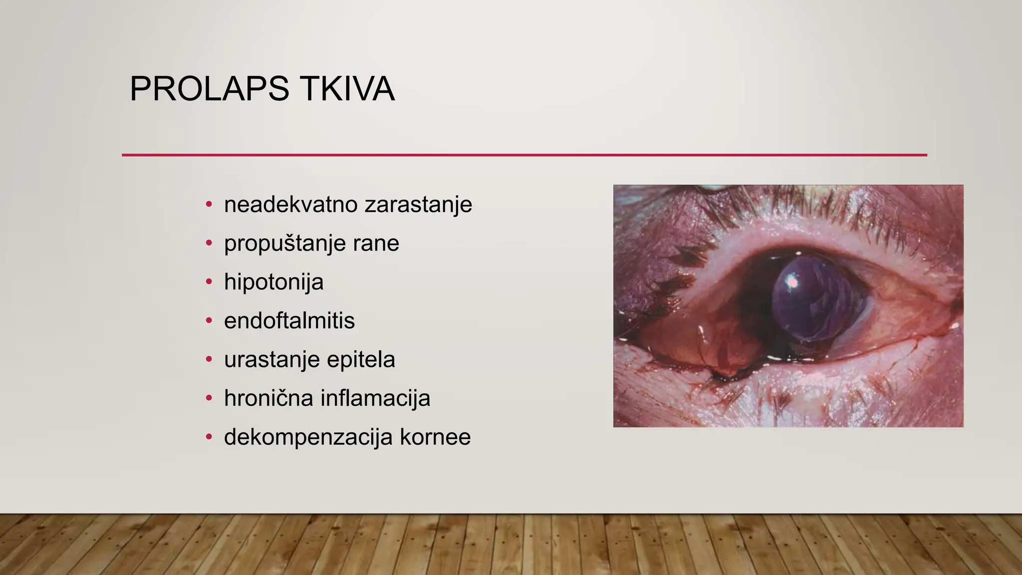 mehanicke Povrede oka i pomoc u lecenju | PPT