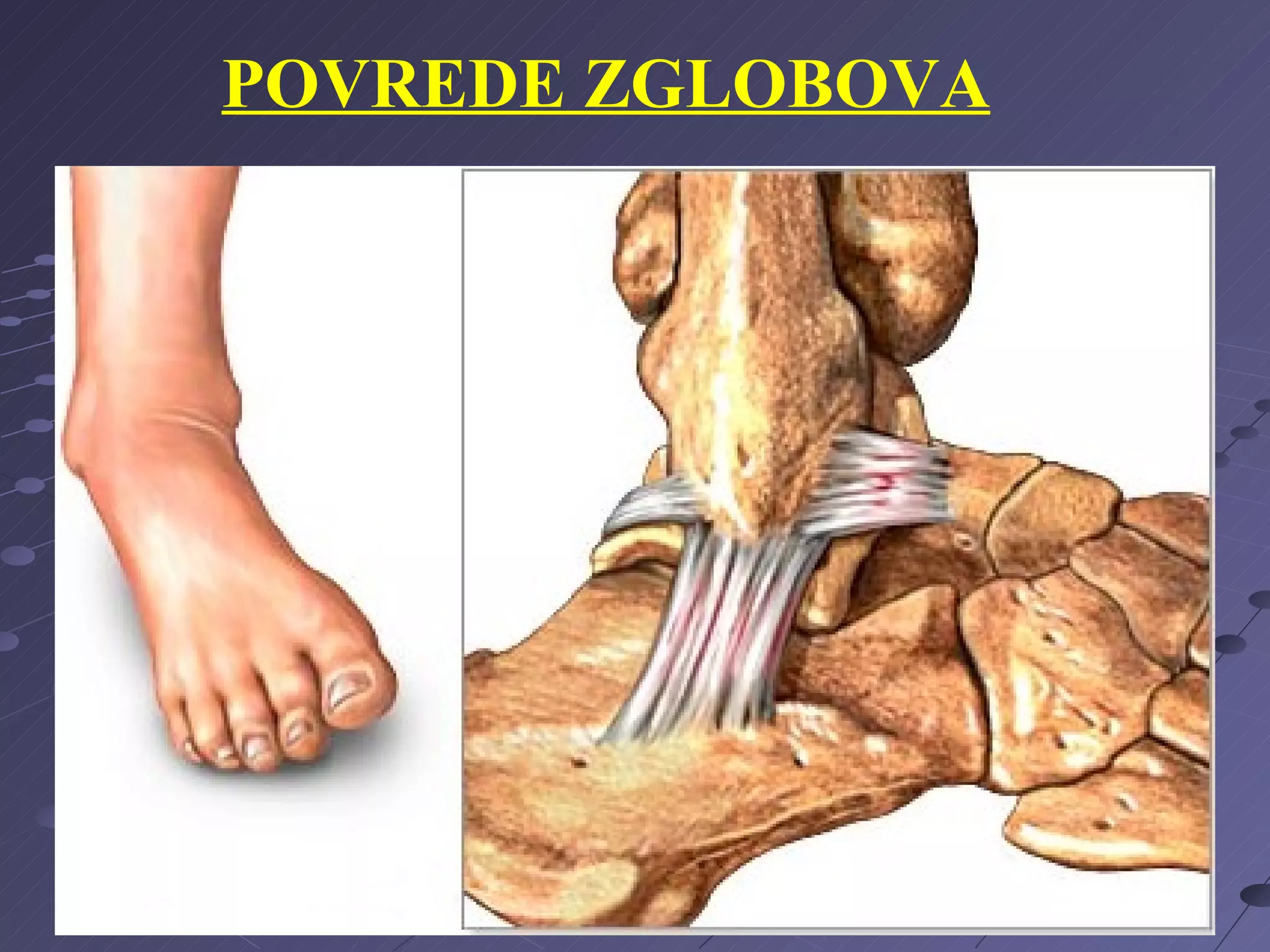 Povrede, previjanje, imobilizacija | PPT