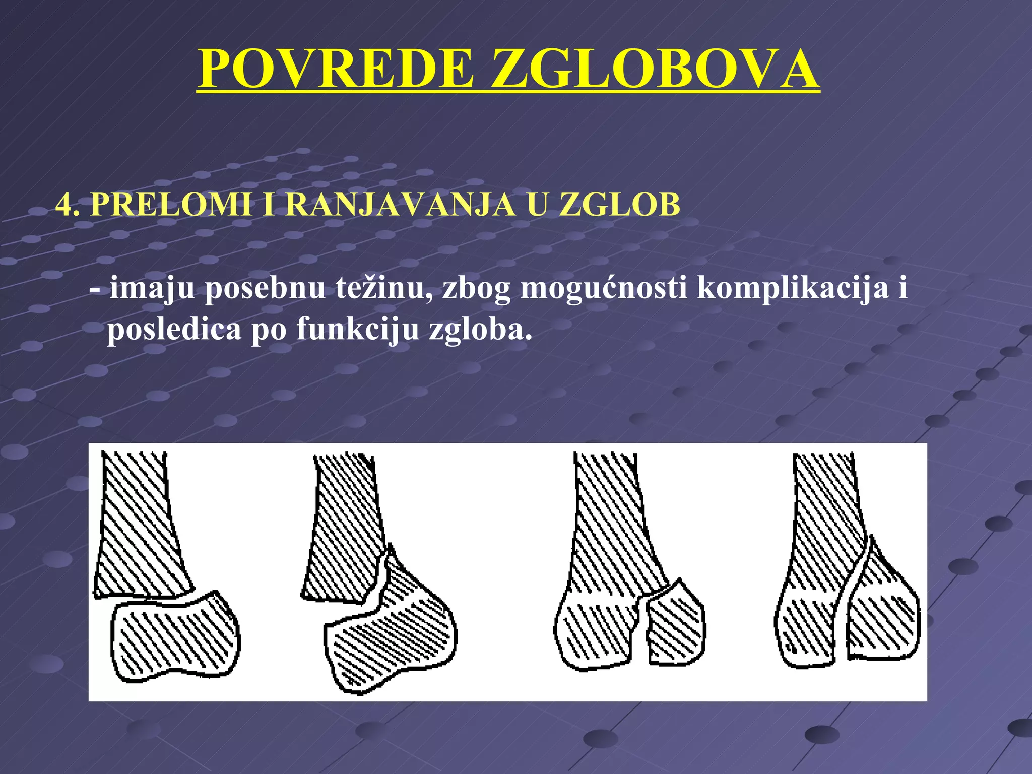 Povrede, previjanje, imobilizacija | PPT