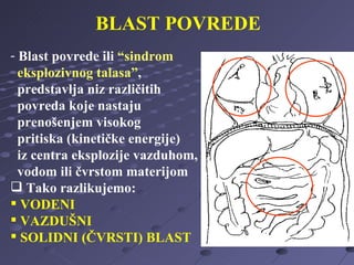 Povrede, previjanje, imobilizacija | PPT
