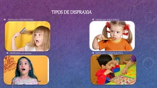 Power dispraxia | PPTX