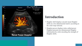 Power Doppler & Extended FOV.pptx Ultrasound | PPTX