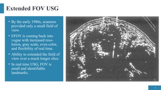 Power Doppler & Extended FOV.pptx Ultrasound | PPTX