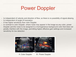 Power Doppler,MRS,SWI.pptx