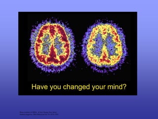 National Institute on Drug Abuse (NIDA) PPT Presentation | PPT