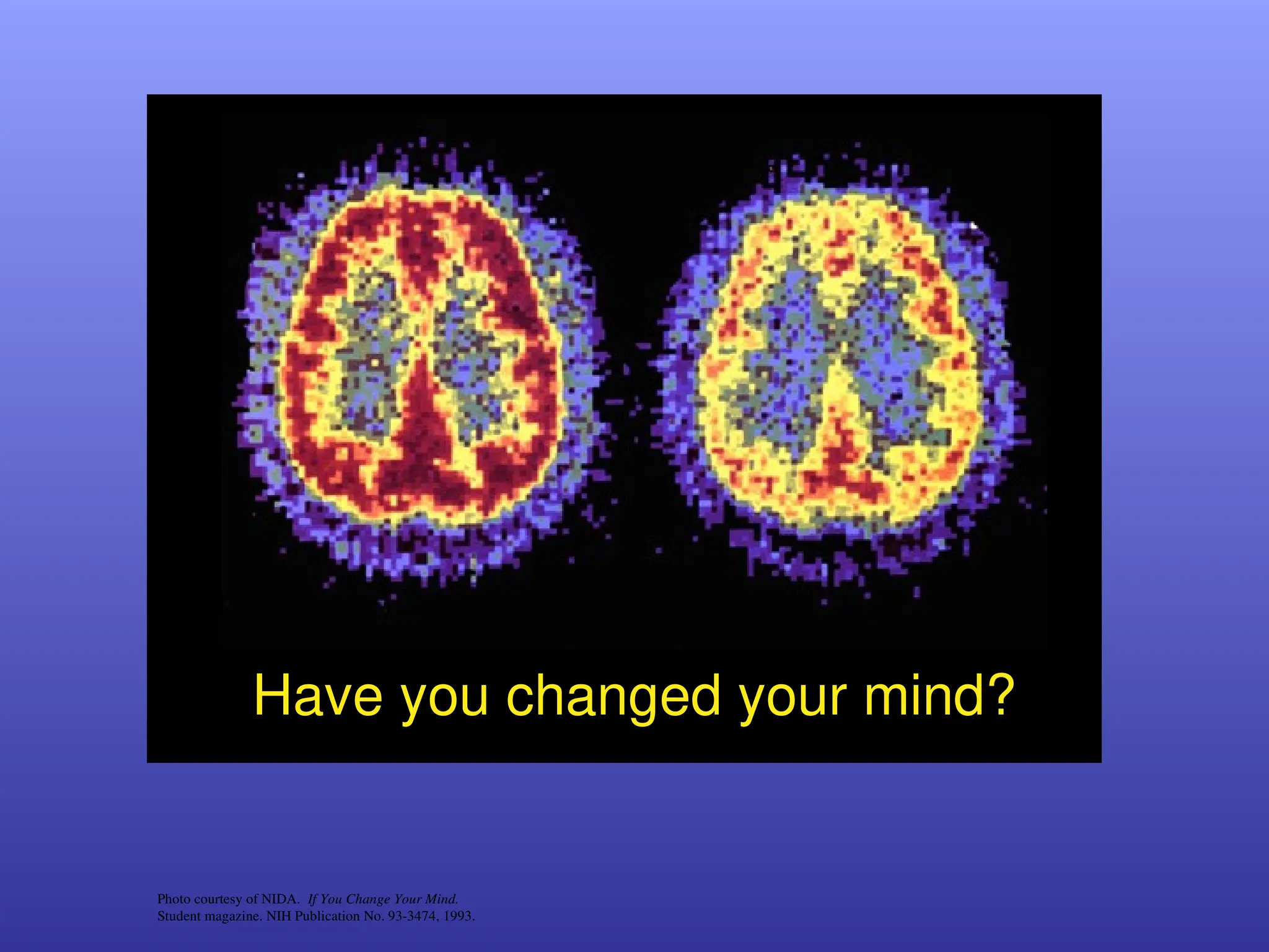 Science of Drugs and its effect on the brain.ppt