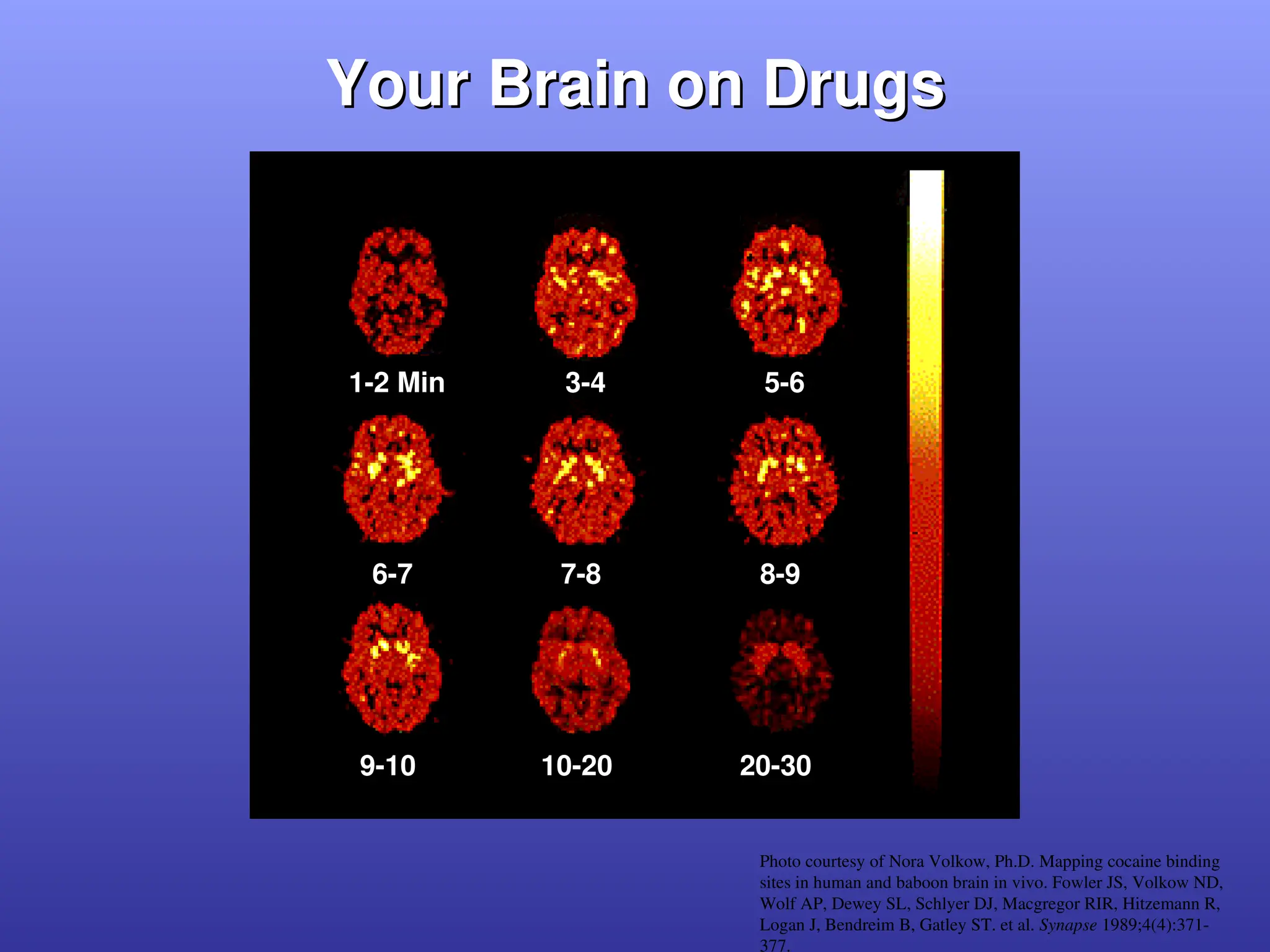Science of Drugs and its effect on the brain.ppt