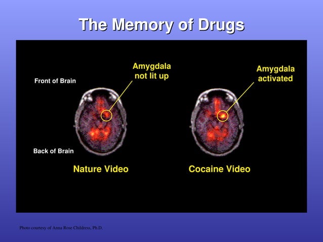 Science of Drugs and its effect on the brain.ppt