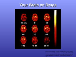 Science of Drugs and its effect on the brain.ppt
