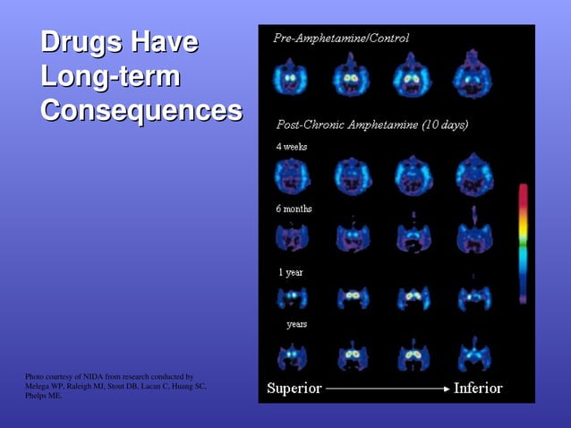 Science of Drugs and its effect on the brain.ppt