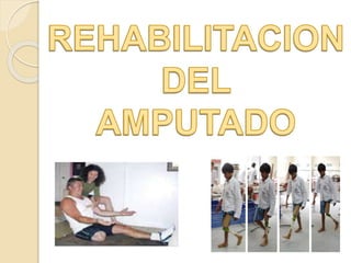 Rehabilitacion del amputado | PPTX