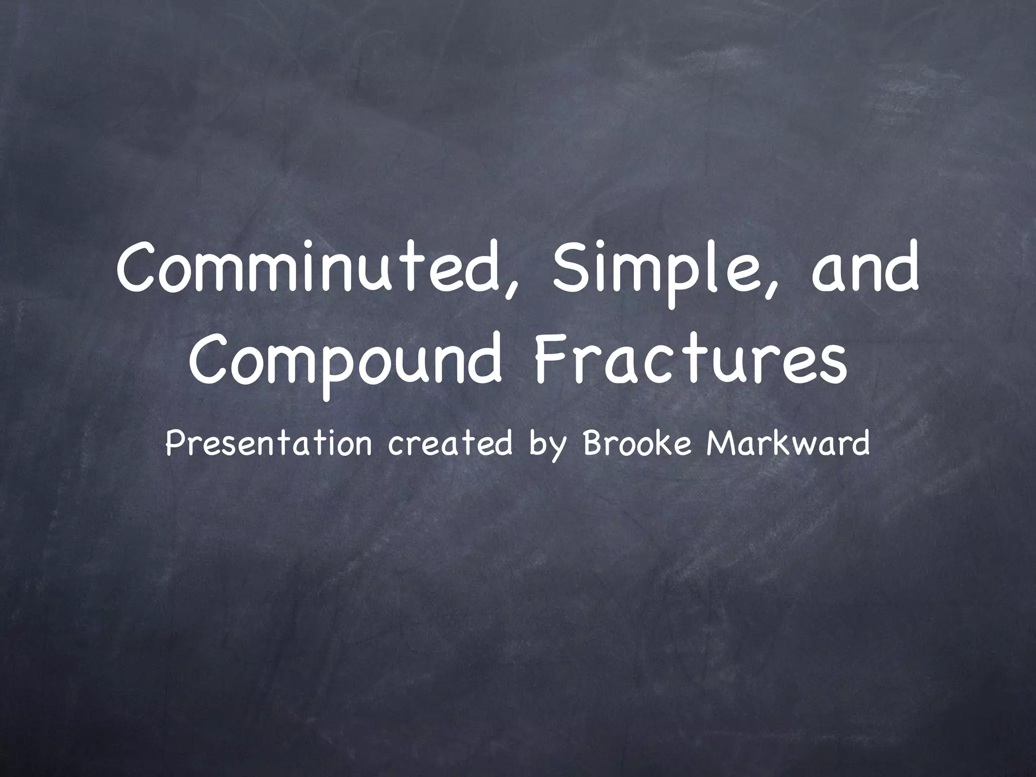 Comminuted, Simple, and Compound Fractures | PPT