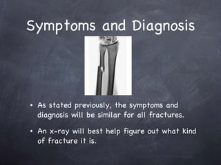Comminuted, Simple, and Compound Fractures | PPT
