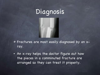 Comminuted, Simple, and Compound Fractures | PPT