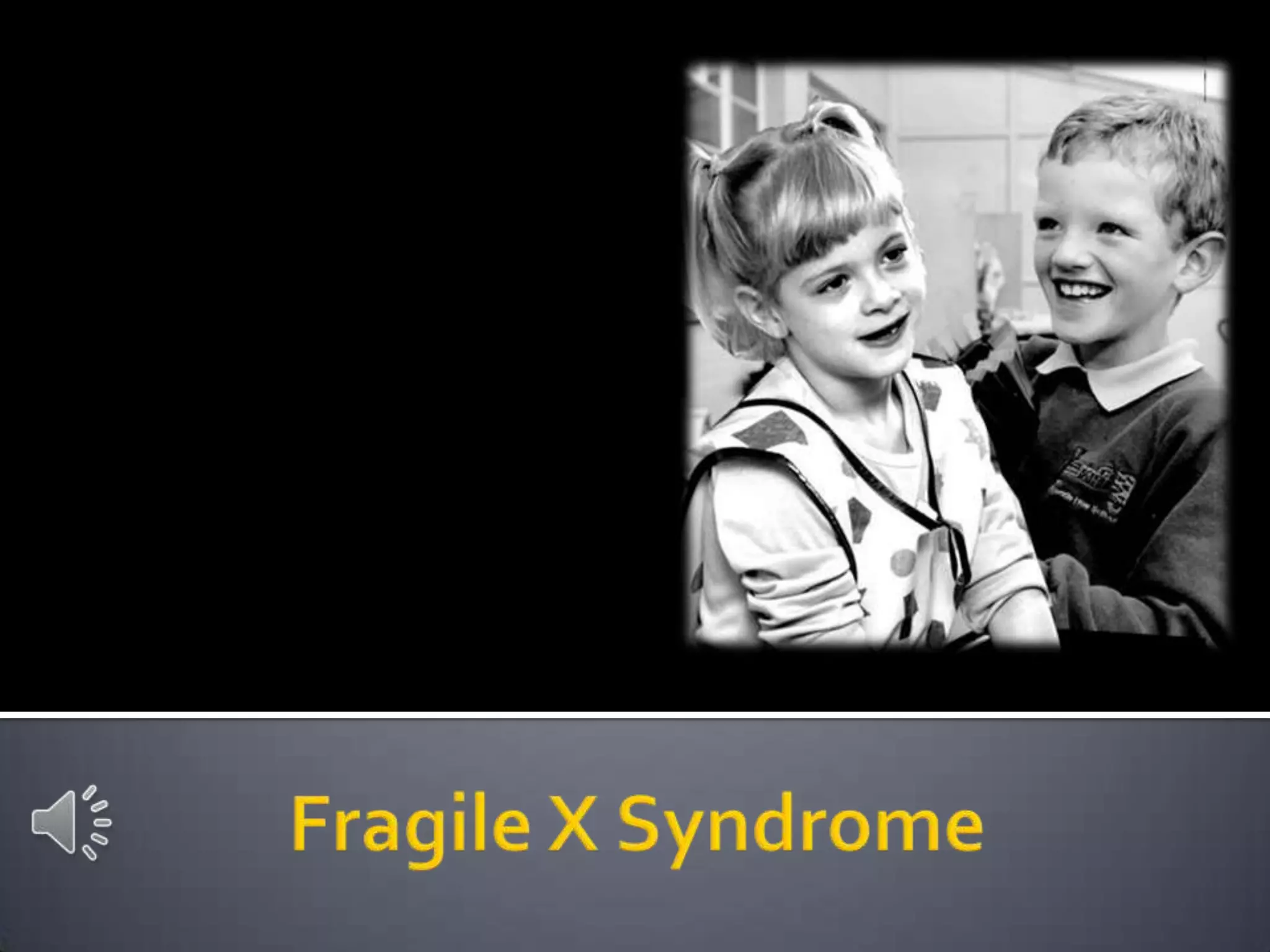 Fragile X Syndrome | PPTX