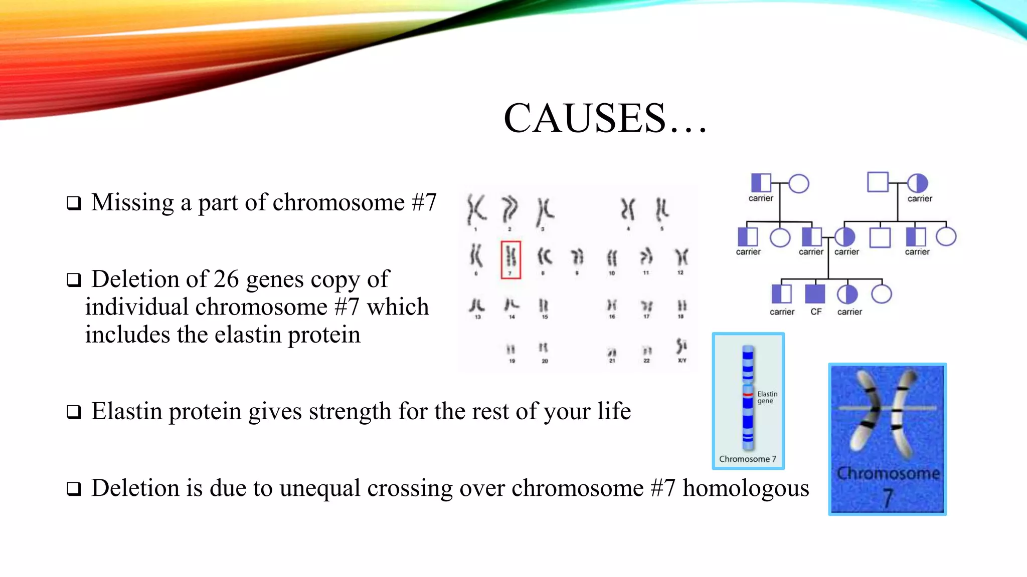Williams Syndrome | PPTX
