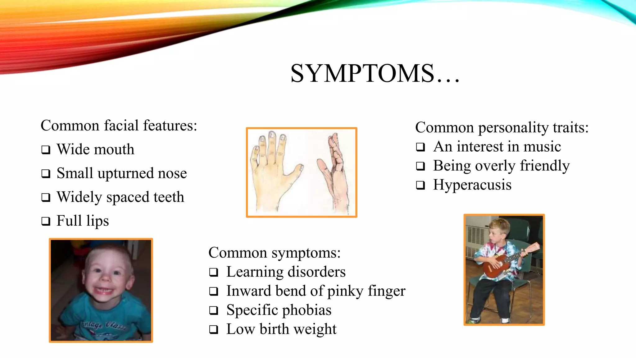 Williams Syndrome | PPTX