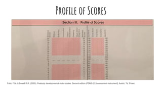 Peabody Developmental Motor Scales (PDMS) - 2 | PPTX