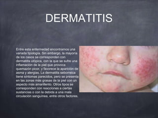 ENFERMEDADES DE LA PIEL | PPTX