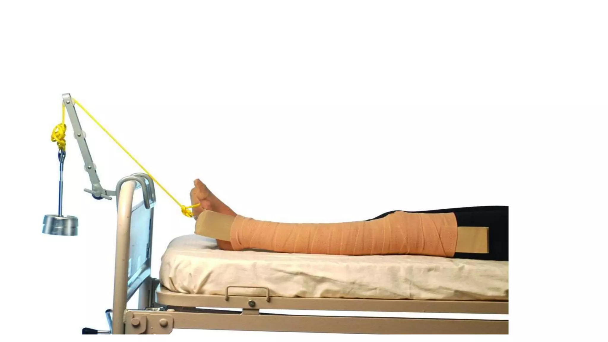 indication and contra-indication cast & traction | PPTX