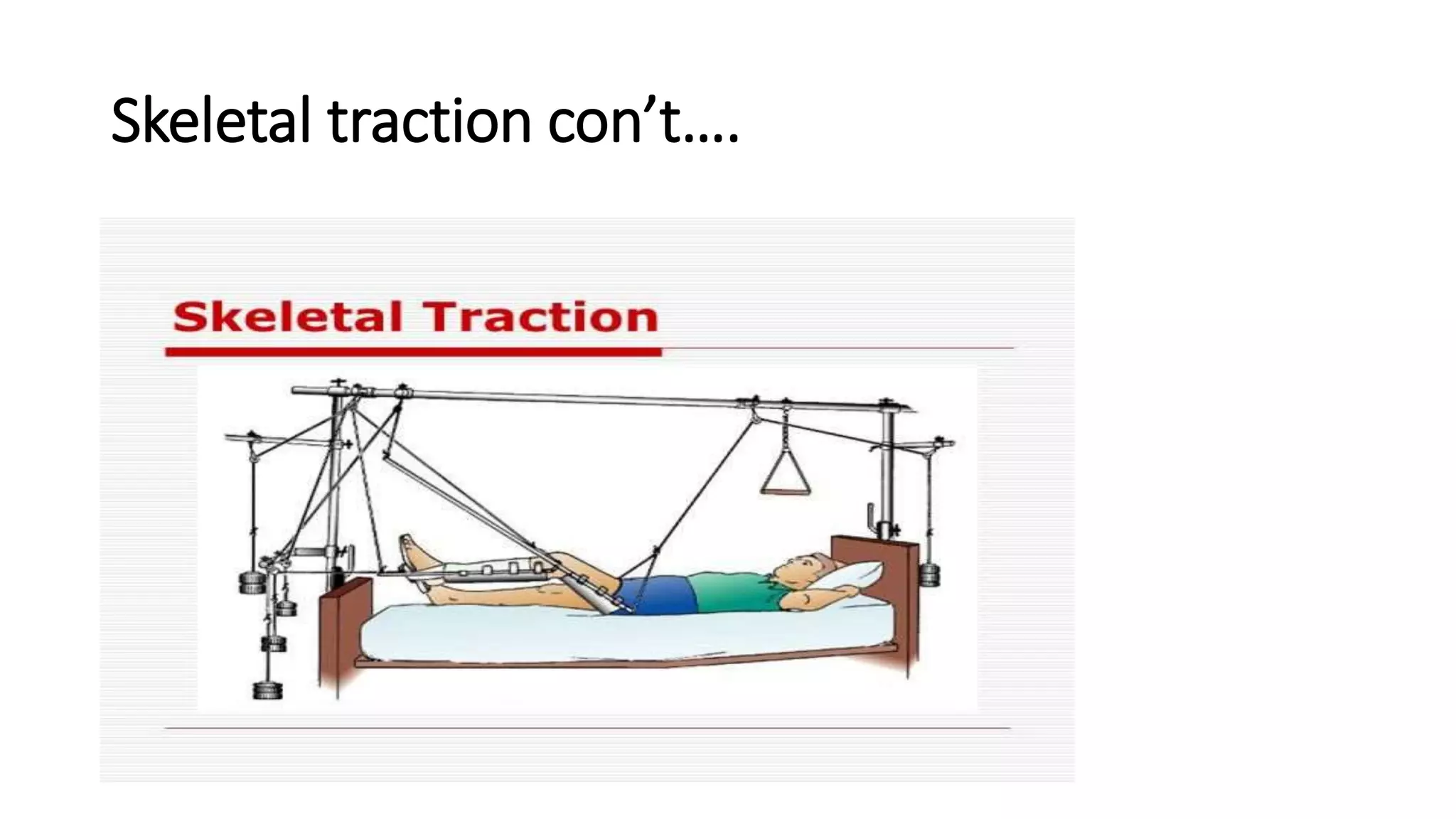 indication and contra-indication cast & traction | PPTX